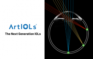 ArtIOLs®: First Inverted Meniscus Optics IOLs delivering Superior ...