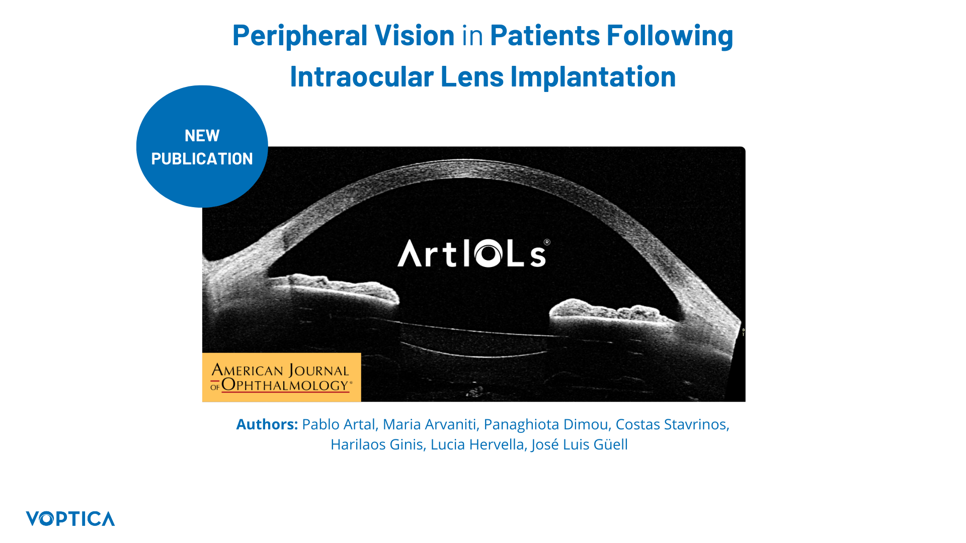 ArtIOLs®: New Publication on Peripheral Vision in Patients Following ...
